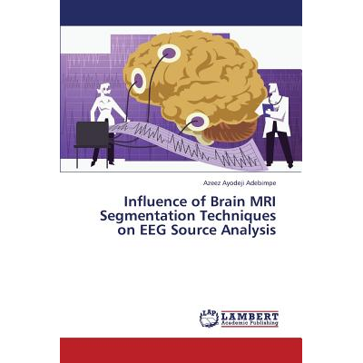 Influence of Brain MRI Segmentation Techniques on Eeg Source Analysis ...