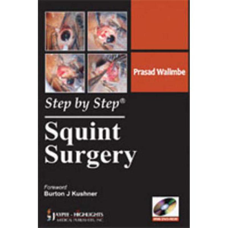Squint Surgery Step-by-Step Prasad Walimbe - Jarir.com KSA