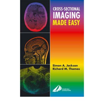 Cross-Sectional Imaging Made Easy Made Easy Simon Jackson - مكتبة جرير ...
