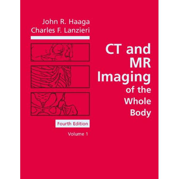 CT and MR Imaging of The Whole Body, 4th Edition John Haaga - Jarir.com ...