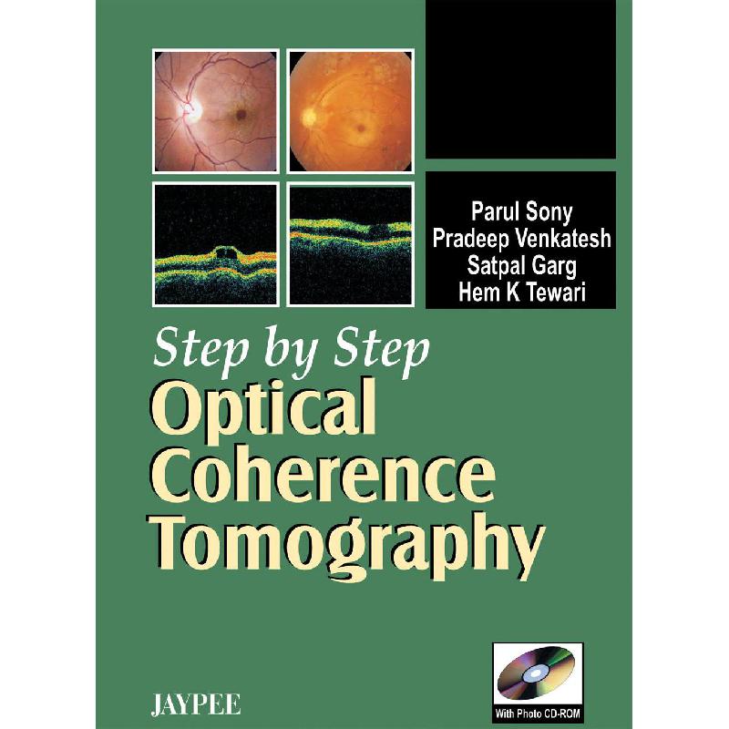 Optical Coherence Tomography Step-by-Step Parul Sony في مكتبة جرير السعودية