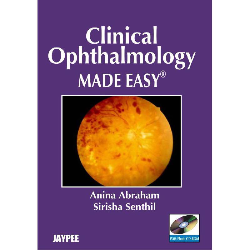 Clinical Ophthalmology Made Easy Anina Abraham - Jarir.com KSA