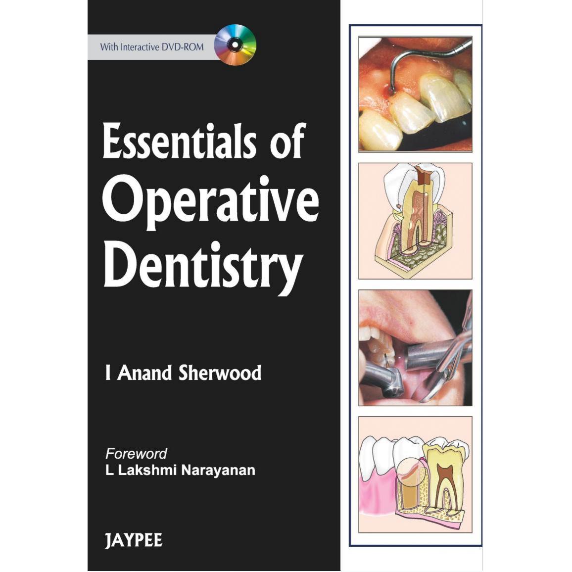 Essentials of Operative Dentistry I. Anand Sherwood - Jarir.com KSA