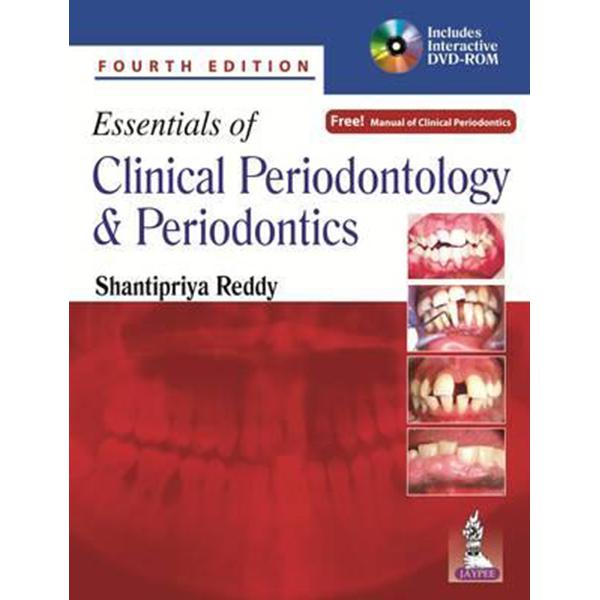 Essentials of Clinical Periodontology & Periodontics Shantipriya Reddy ...