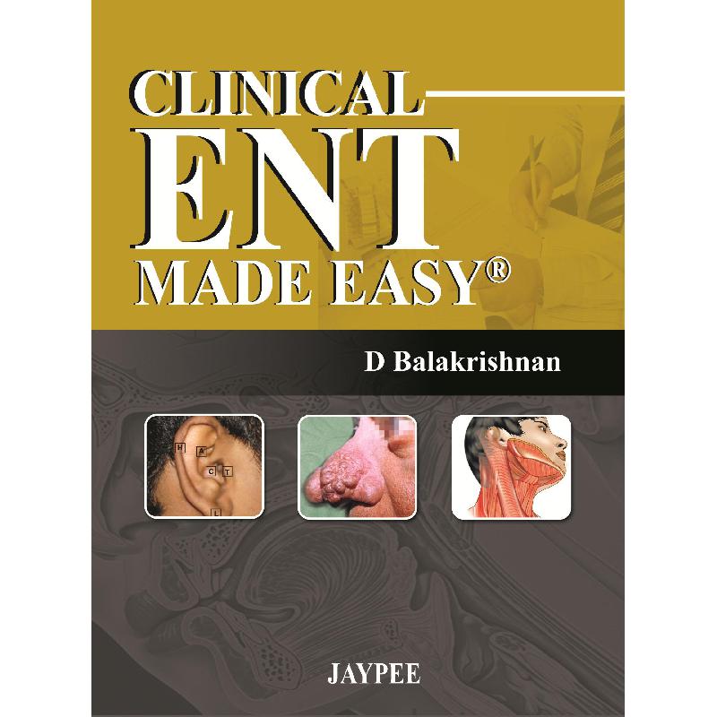 Clinical ENT Made Easy: A Guide to Clinical Examination D. Balakrishnan ...